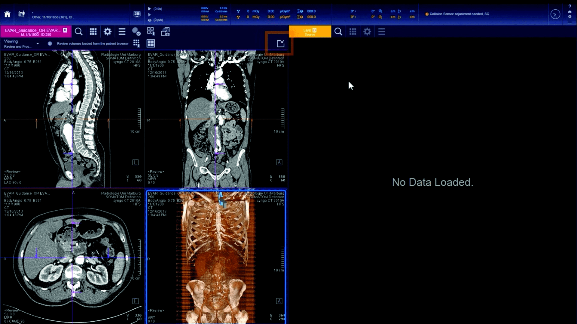 SmartSimulator: simulation for radiology - SIMZINE